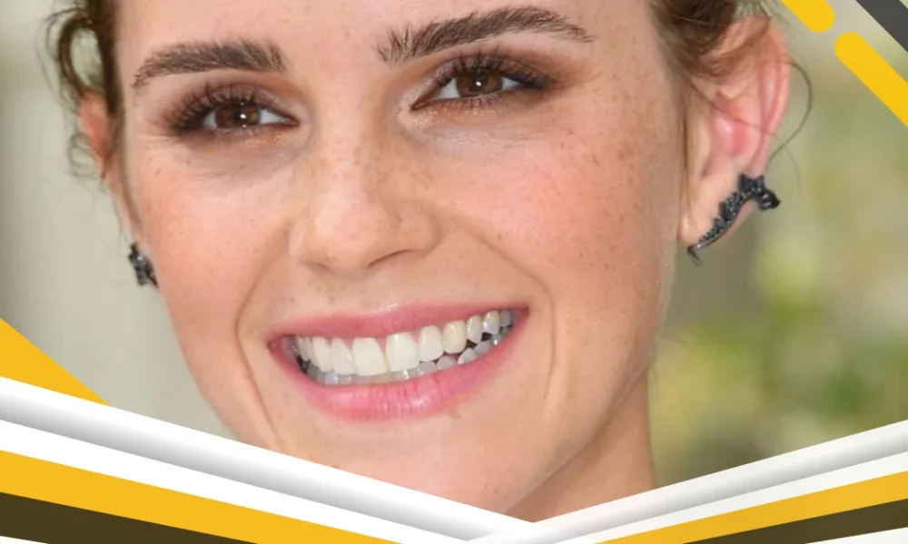 Emma Watson y su camiseta corta sin nada debajo: análisis y